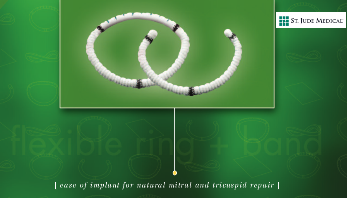 Cardiac Surgery – LHI – LIFE HEALTH INDUSTRY